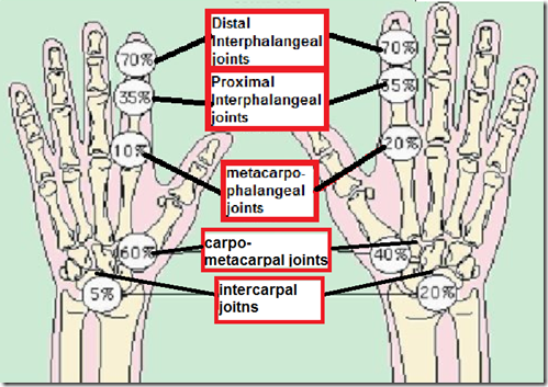 Intertarsal Joint Type